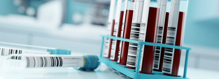 What Happens to Your Blood Sample? - Your Pathologist