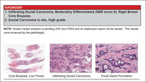 Your Diagnosis - Your Pathologist