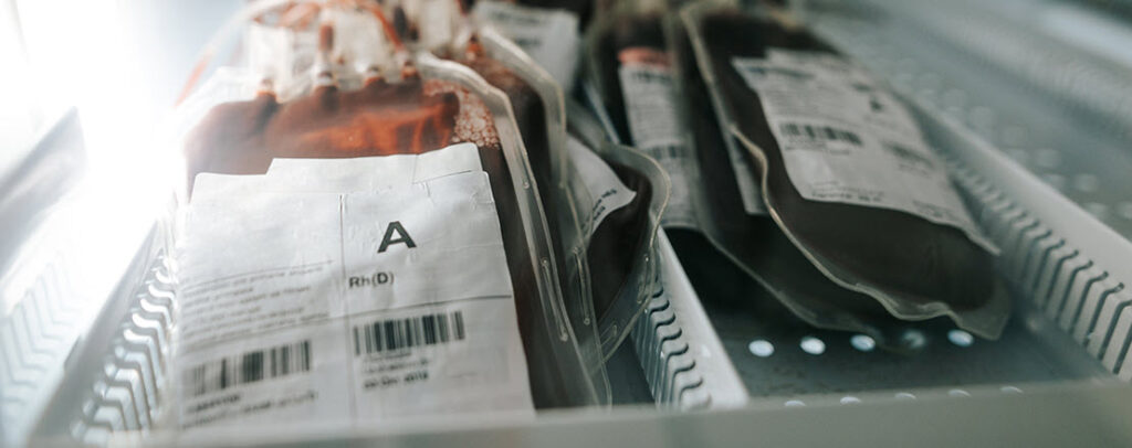 How to Determine Your Blood Type - Your Pathologist